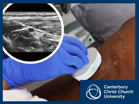 Ultrasound Guided Nerve Blockade Course