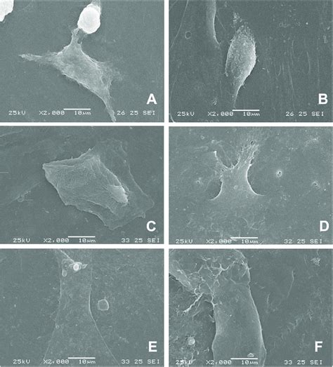 Scanning Electronic Microscopy Sem Of Mscs Cultured By 24hs On