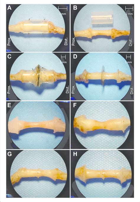 Excised Regenerated Sciatic Nerve At 3 Months Post Operation Photos