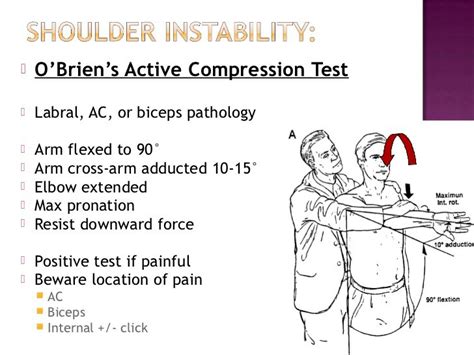 Shoulder Dislocation Test At Sammy Parra Blog