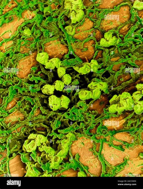 False Colour Scanning Electron Micrograph Of The Green Algae Pleurococcus Sp Which Forms A