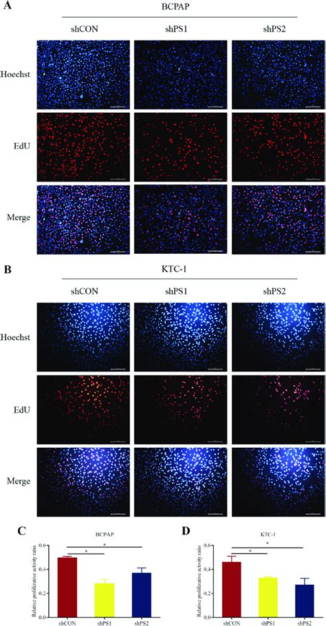 Edu Assay Of Pros1 Knockdown Groups And Control Groups Of The Two Cell