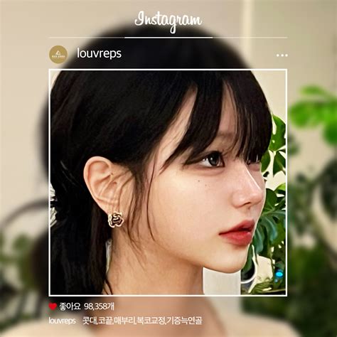 루브르성형외과 처음처럼 자연스럽게 전후사진후기셀카후기