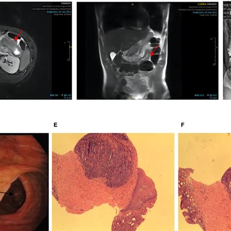 Classification Provided By Mcpherson Ag Download Scientific Diagram