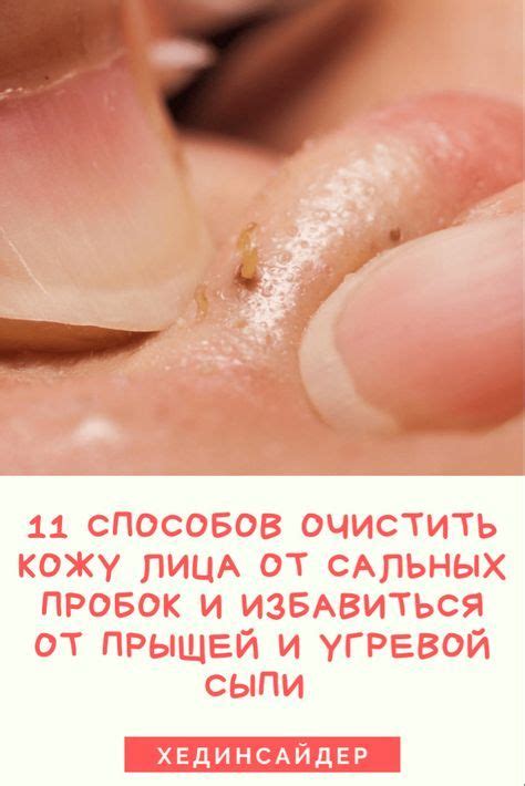 11 способов очистить кожу лица от сальных пробок и избавиться от прыщей