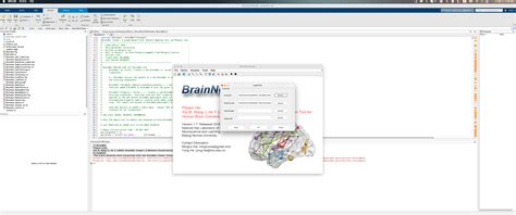 Github Enzexubrainview