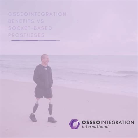 Osseointegration International On Linkedin Osseointegration Osseointegration International On Linkedin Osseointegration