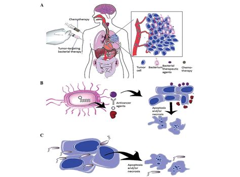 Tumor‑targeting Bacterial Therapy A Potential Treatment For Oral