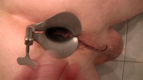 The Garden Worms And Earthworms Are Injected With A Large Syringe