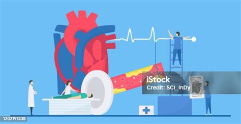 심장 벡터 그림입니다 이 질병은 관상 동맥의 협연입니다 Mri는 강한 자기장과 전파를 사용하여 신체의 상세한 이미지를 생성하는