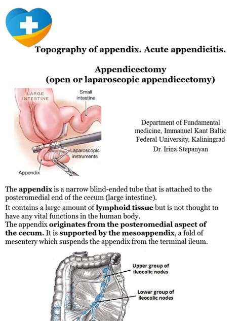 Appendicitis And Appendicectomy Pdf Peritoneum Abdomen
