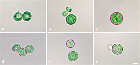 Morphology Of Two Galdieria Species A C G Sulphuraria From Ostrava Download Scientific