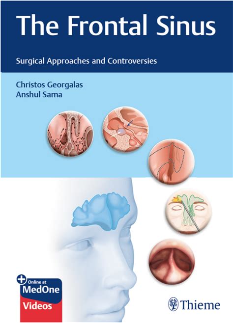 Ebook Pdf The Frontal Sinus Surgical Approaches And Controversies By Christos Georgalas