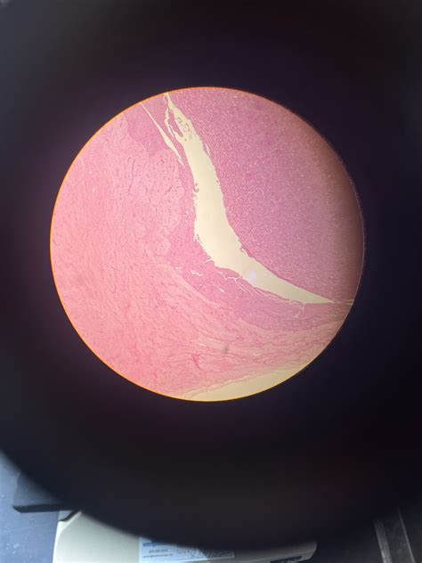 Endocrine System And Brain Functions Practical Lab On Thalamus Pineal