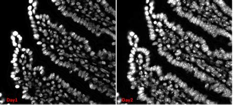 Dapi Staining In Multiplex Ihc Is Fading With Stripping Rounds