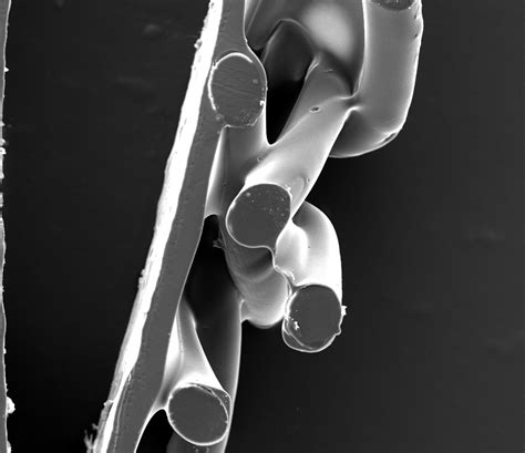 Proheal Ehd Composite Dual Layer Hernia Repair Mesh Plcl Absorbable Hernia Patch