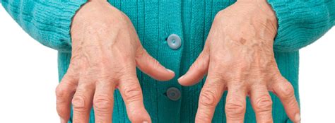 5 Ways Of Managing Rheumatoid Arthritis In Ayurveda Dr Kranthi R Vardhan