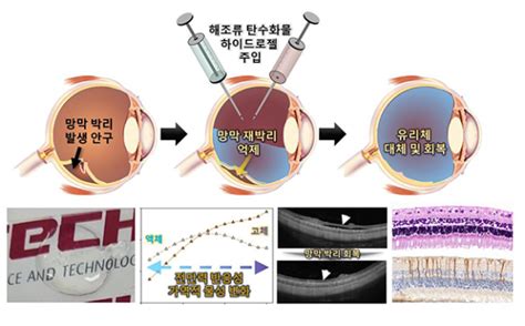 차형준 교수 최근호 박사 해조류 추출 탄수화물로 생체적합 인공 유리체 소재 개발 Magic Lab News 포항공대