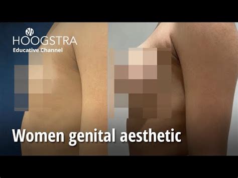 Women Genital Aesthetic YouTube