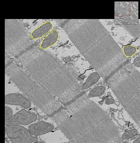 Solidity Measurement In Annotated Areas Image Analysis Imagesc Forum