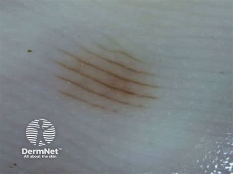 Dermoscopy Course Images