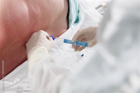 Epidural Anesthesia Injection For Spinal Anesthesia Nerve Blockagean