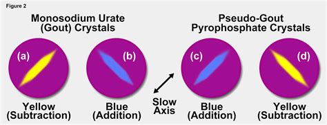 Gout Testing Clinical Research Solutions Nikon Europe Bv