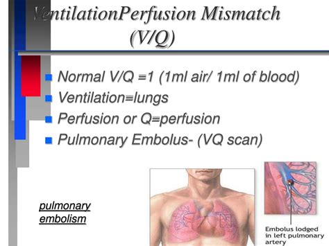 Ppt Respiratory Failure And Ards Powerpoint Presentation Free