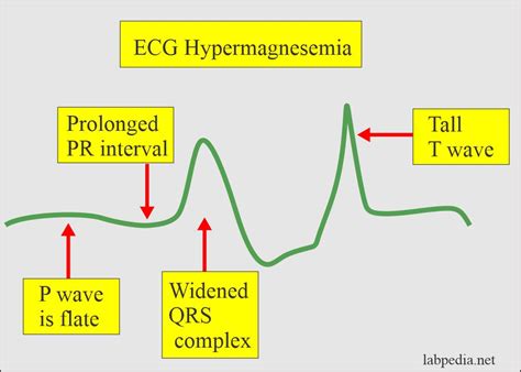 Magnesium Levels Normal Range At Sherry Powers Blog