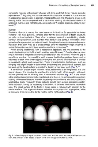 Diastema Correction Of Excessive Spaces PDF