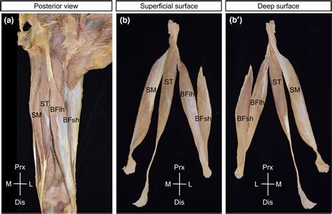 Unique Morphological Architecture Of The Hamstring Muscles And Its