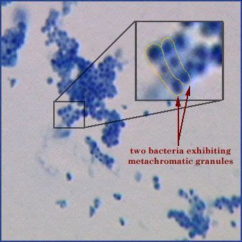 Corynebacterium Has Metachromatic Granules With Methylene Blue