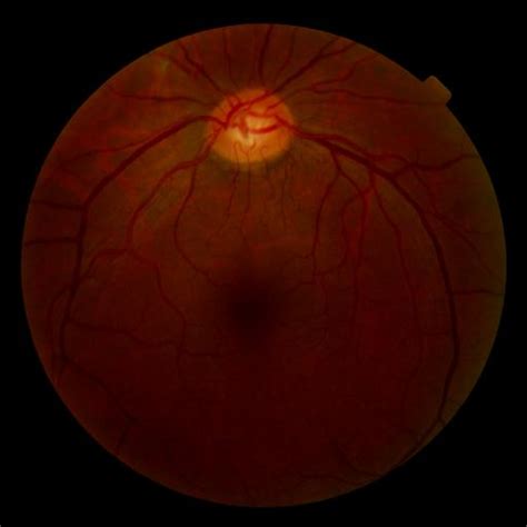 Od Detection V2 Object Detection Dataset By Public