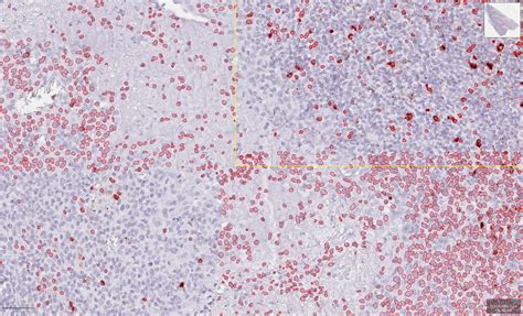 Cellpose Extension In Qupath Cannot Get Deconvolution And