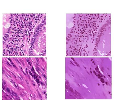 Sample Of Mean Shift Filtering Algorithm On Histopathology Images Download Scientific Diagram