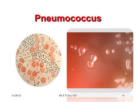 Streptococcus Pneumoniae Ppt