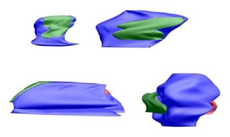 3d Reconstruction Of Single And Double Synapse Spines From Serial