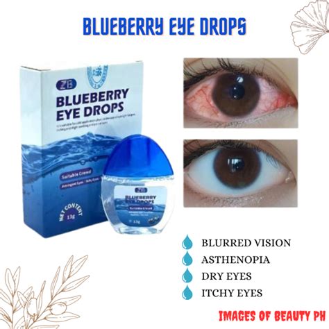 blueberry eye drops for sore eyes itchy eyes dry eyes blurred vision