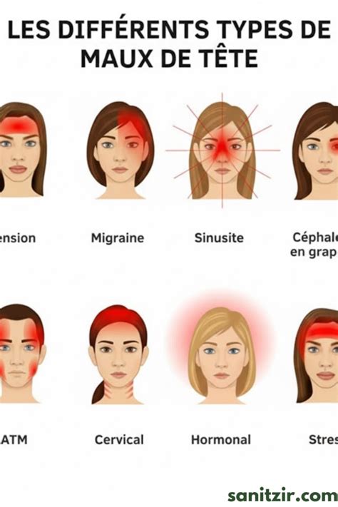 🌿 Types De Maux De Tête Et Leurs Zones Les Plus Fréquentes Ricette E
