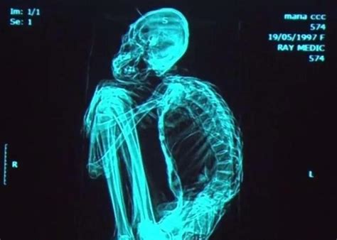 Dna Expert Confirms At Least One Type Of The Nazca Mummies Is Part Of