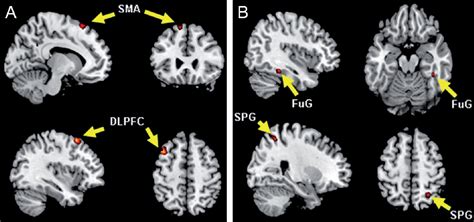 Figure 2 From Neural Correlates Of Emotioncognition Interaction During Working Memory