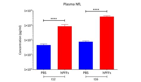 α Synuclein Preformed Fibril Pff 模型