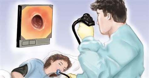 Endoscopy How Long To Fast At Esther Thompson Blog