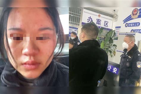 远嫁女子被公公家暴：当着她1岁儿子面打，醒来时已在医院