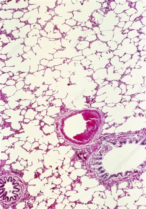 Lm Of A Cross Section Through Lung Tissue Stock Image P590 0172 Science Photo Library