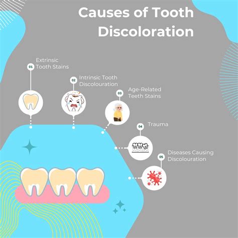 Tooth Discoloration Causes