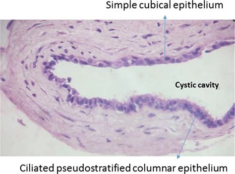 Simple Ciliated Columnar Epithelium