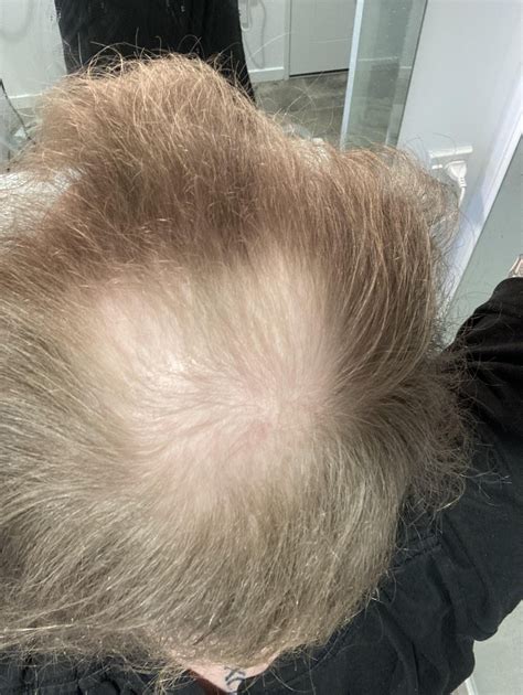 Hi Guys I Recently Shaved My Hair All Off And Got Some Great Feed Back