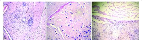 The Pathological Findings Download Scientific Diagram