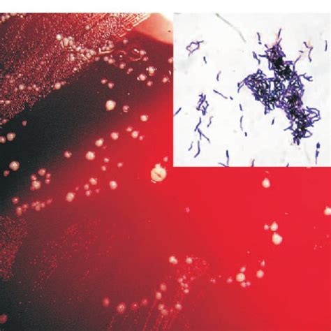 Algorithm For The Identification Of Gram Positive Non Spore Forming